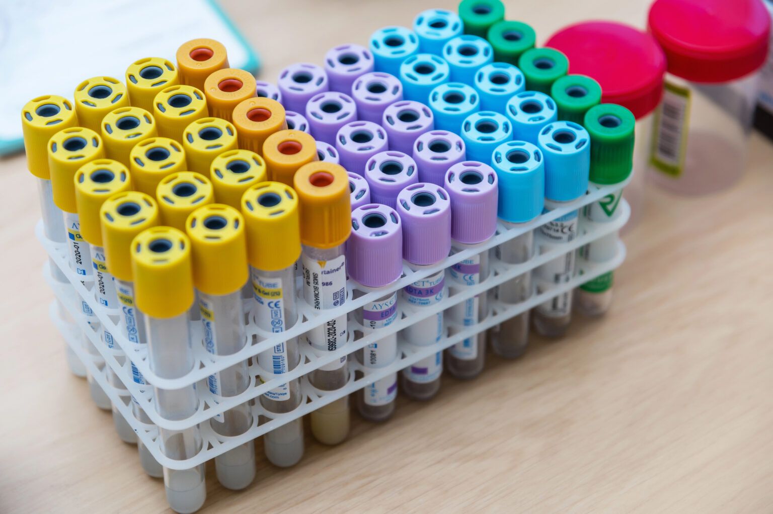Color Coding Medical Imaging Labels to Improve Workflow | Nev’s Ink